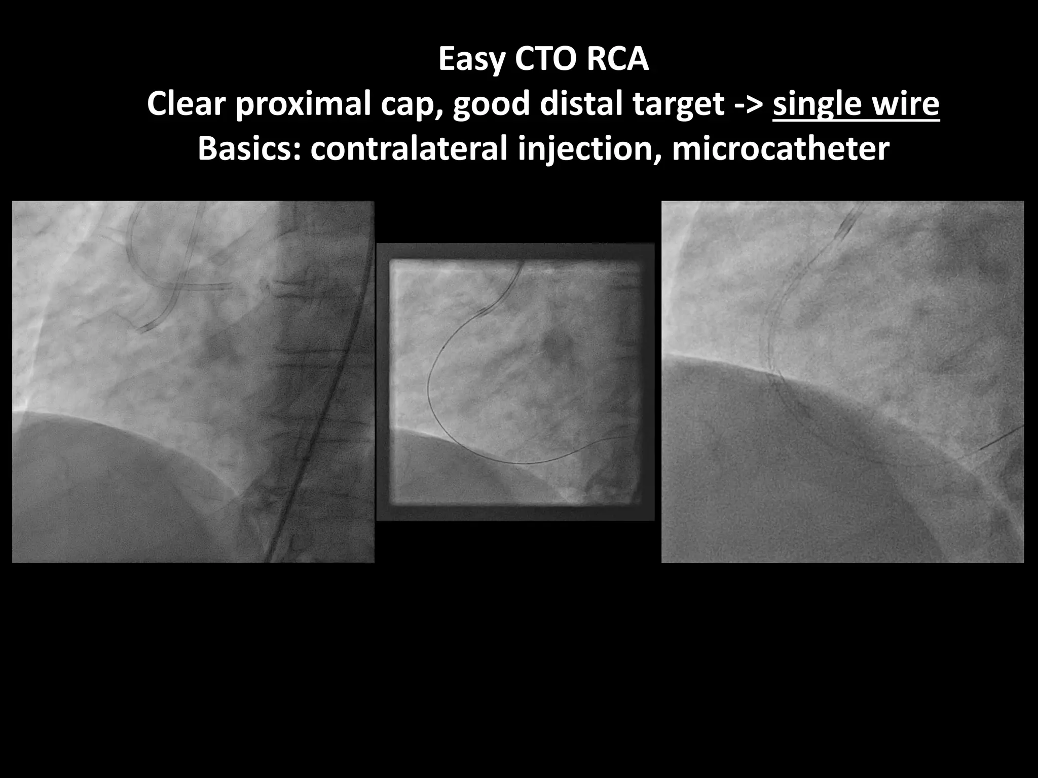Meyer-Geßner - Session 1 - Antegrade euro cto algorithm | PDF