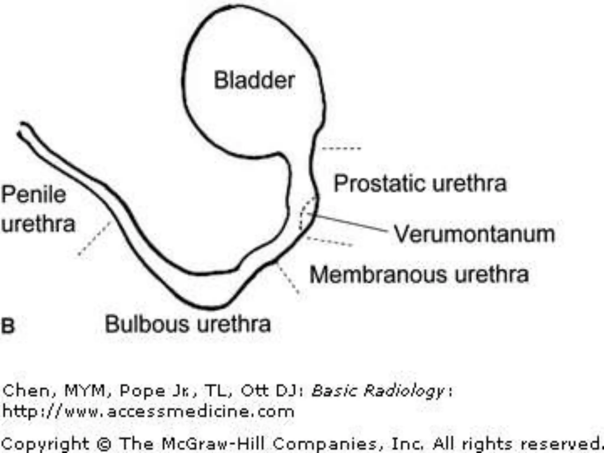 Antegrade & retrograde urethrogram | PPTX
