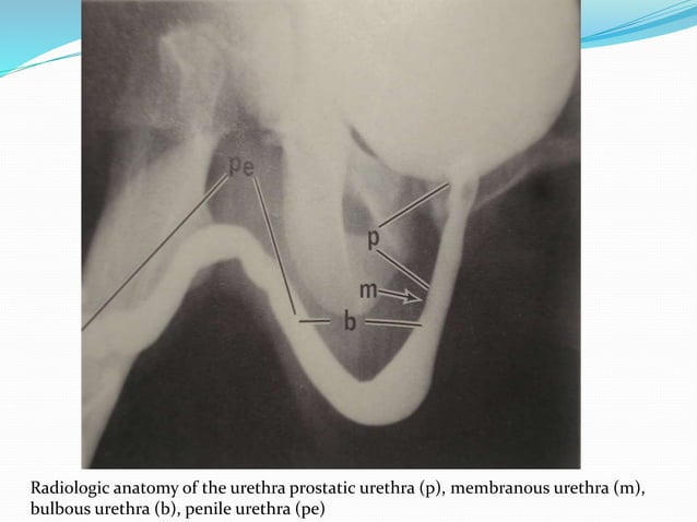 Antegrade & retrograde urethrogram | PPTX | Medical Tests | Medical Health