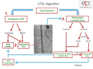 Antegrade – step by step approach | PDF