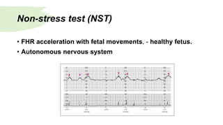 Antenatal assesment of featl well being | PPTX