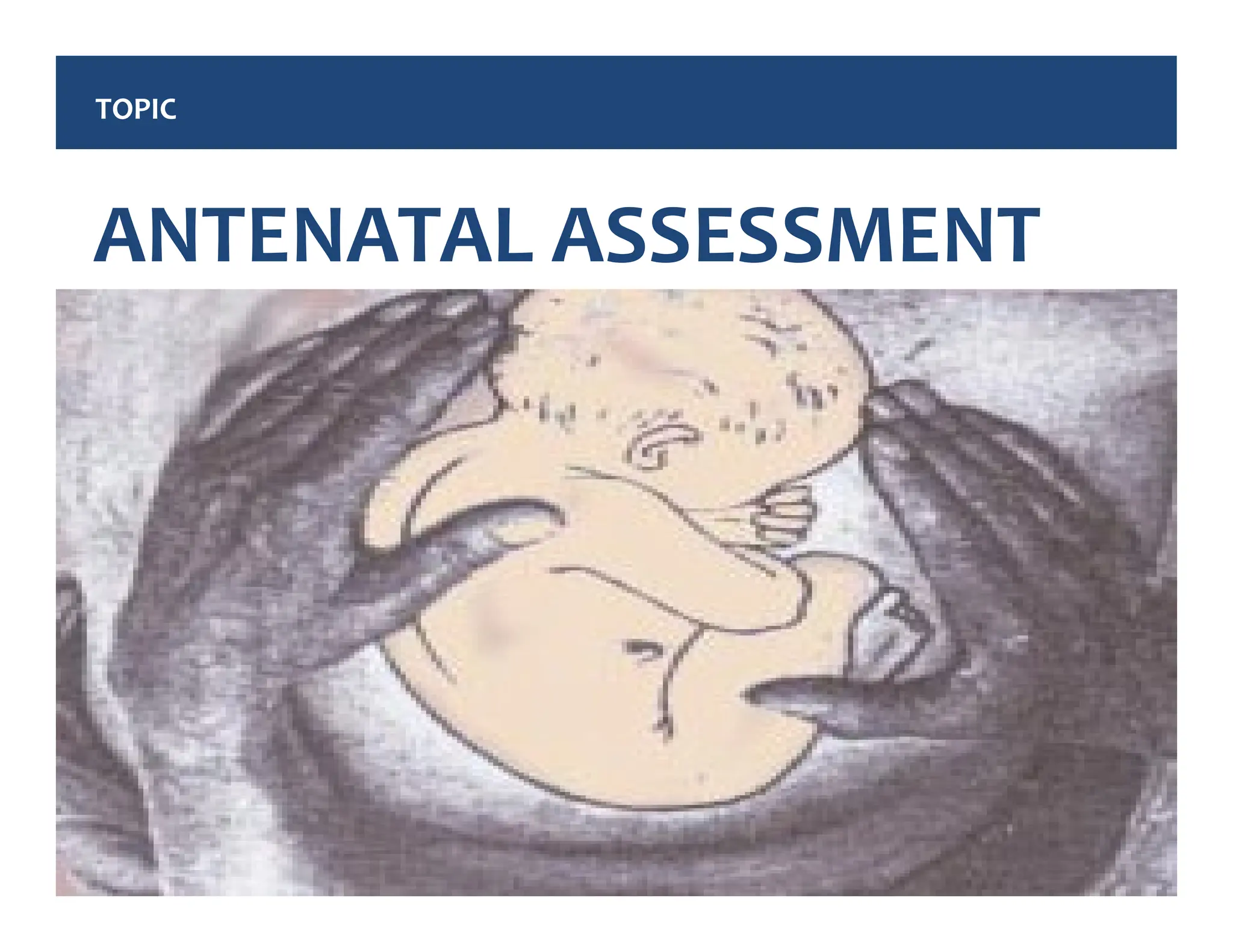 ANTENATAL ASSESSMENT format for history taking, physical examination | PDF
