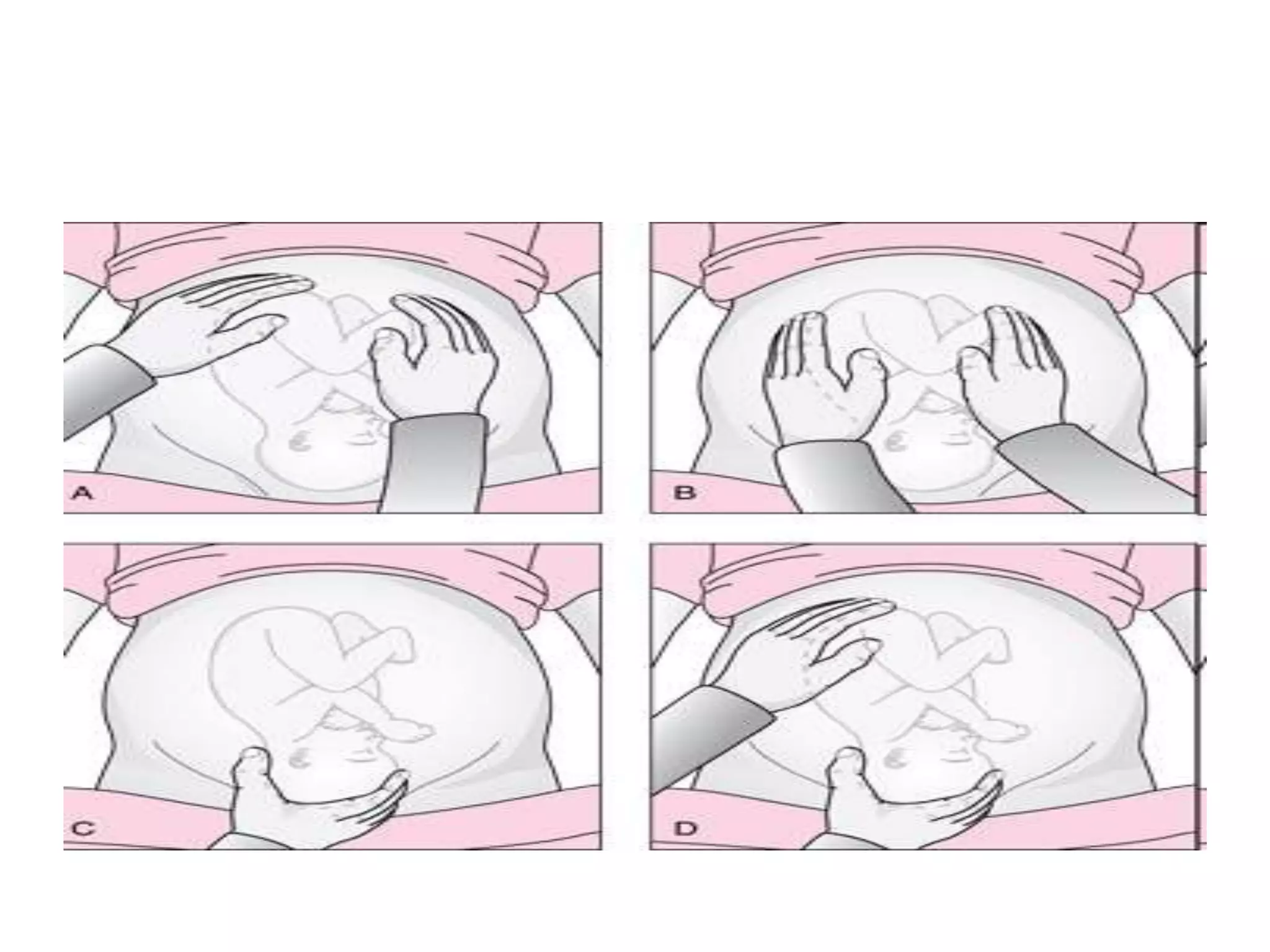 antenatal care.ppt