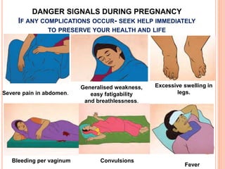 Health Education on Antenatal care | PPTX