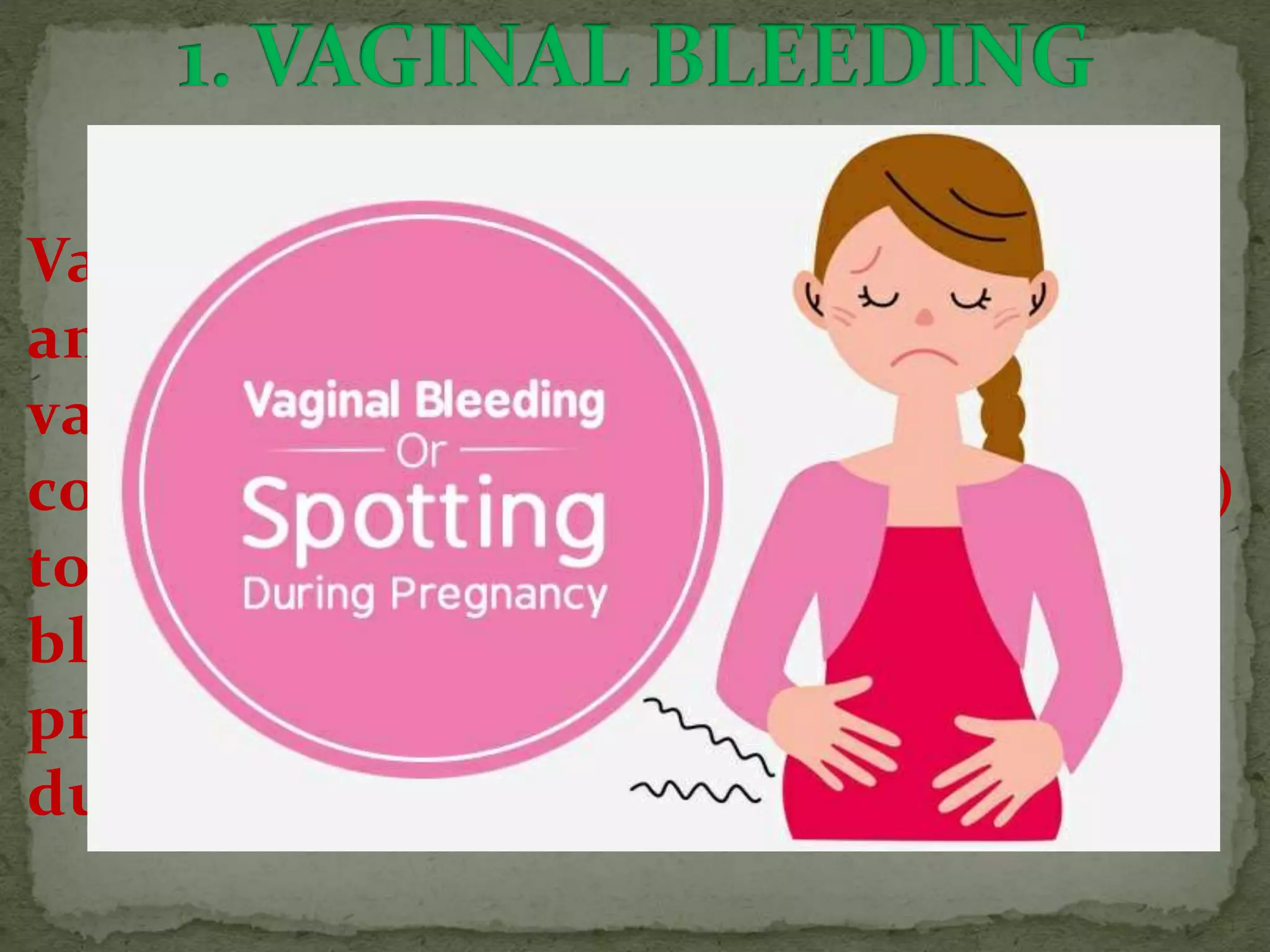 Danger sign of antenatal | PPTX