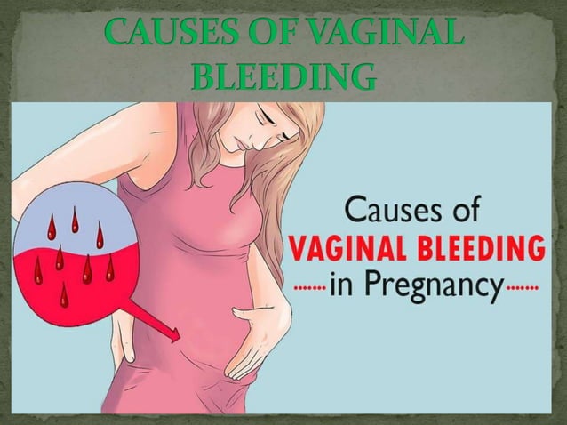 Danger sign of antenatal | PPTX | Pregnancy | Reproductive Health