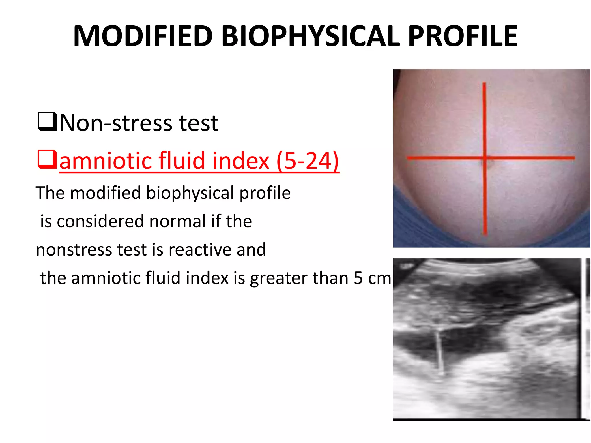 Antenatal fetal monitoring | PPTX