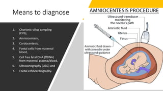 Antenatal monitoring of fetal well being 2 | PPT