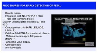Antenatal monitoring of fetal well being 2 | PPT