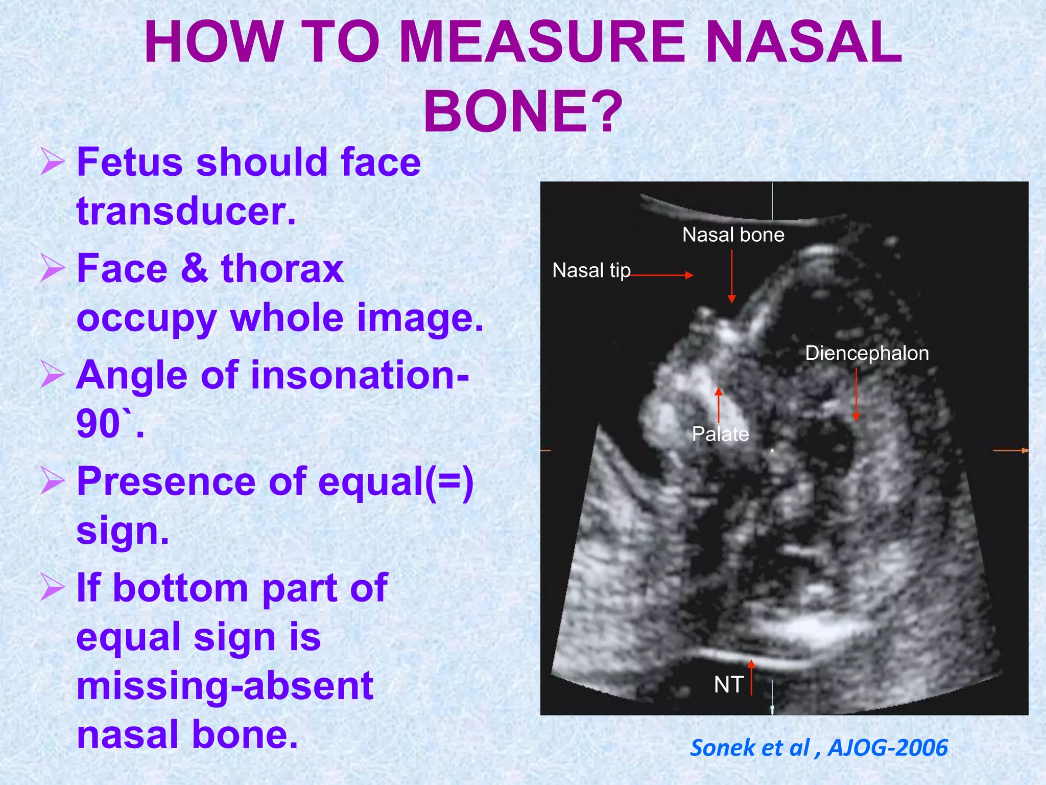 ANTENATAL_SCREENING_IN_FIRST_AND_SECOND_TRIMESTER.ppt