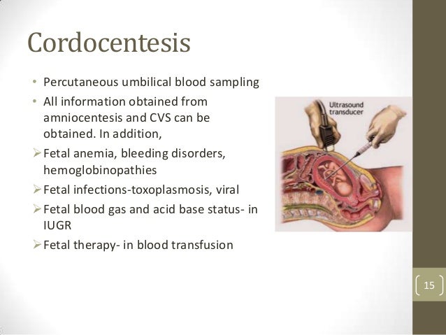 Antepartum fetal surveillance