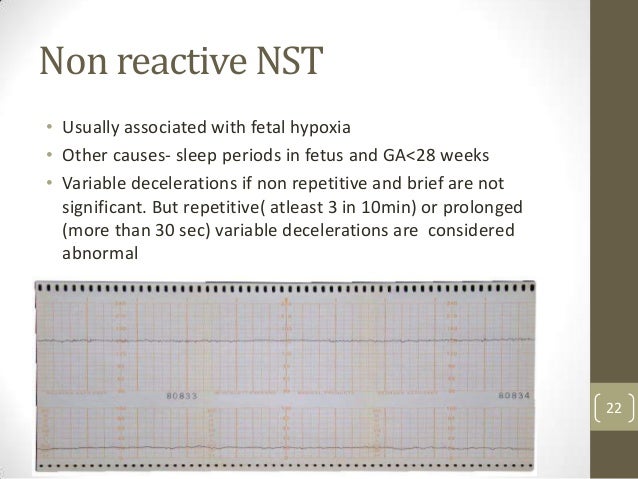 Antepartum fetal surveillance
