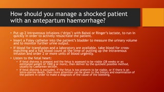 Antepartum Haemorrage.pdf