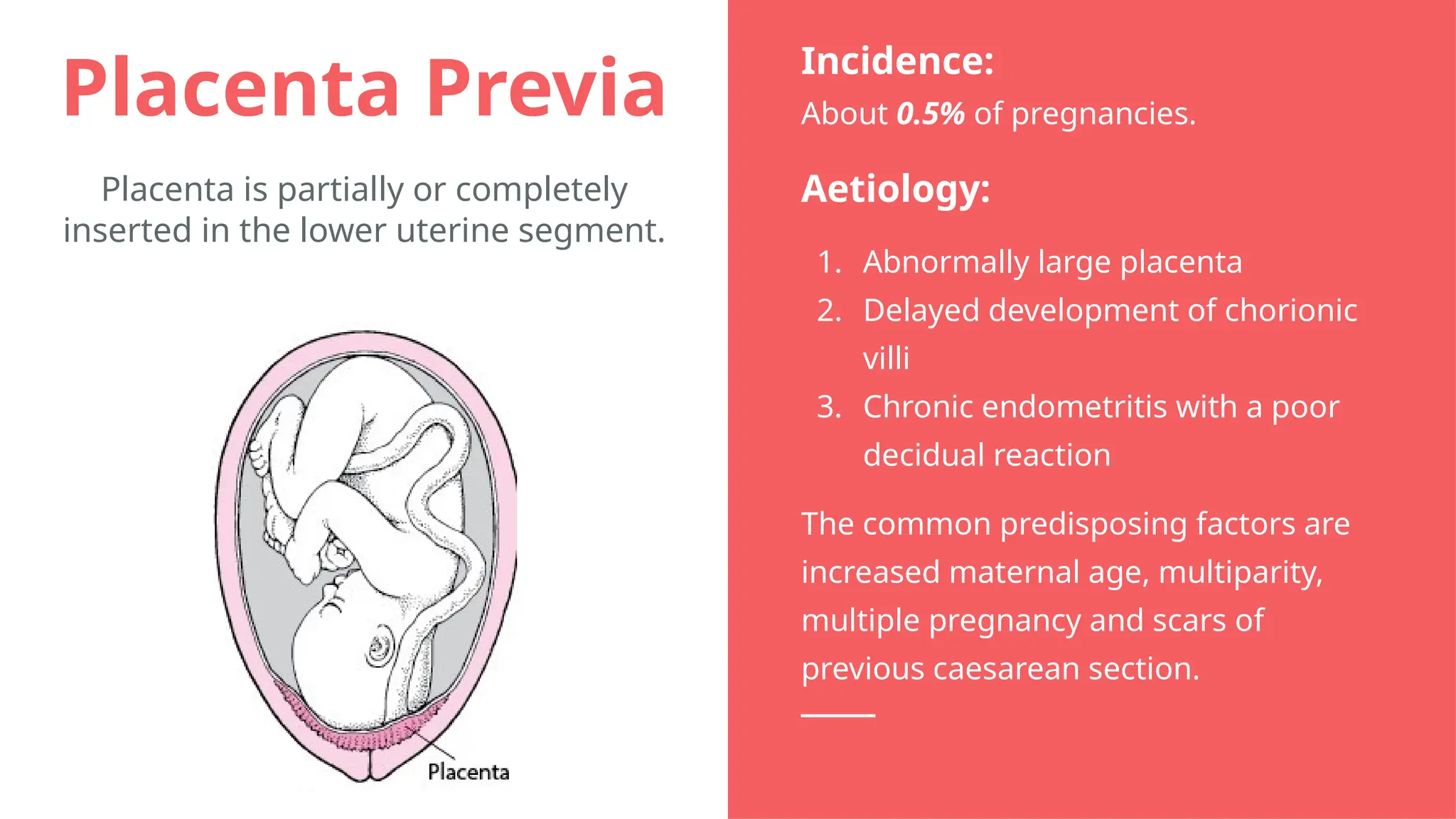 Antepartum Hemorrhage - Faculty of Nursing, Suez Canal University.pptx.pptx