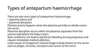 Antepartum Haemorrhage powerpoint presentation | PPTX
