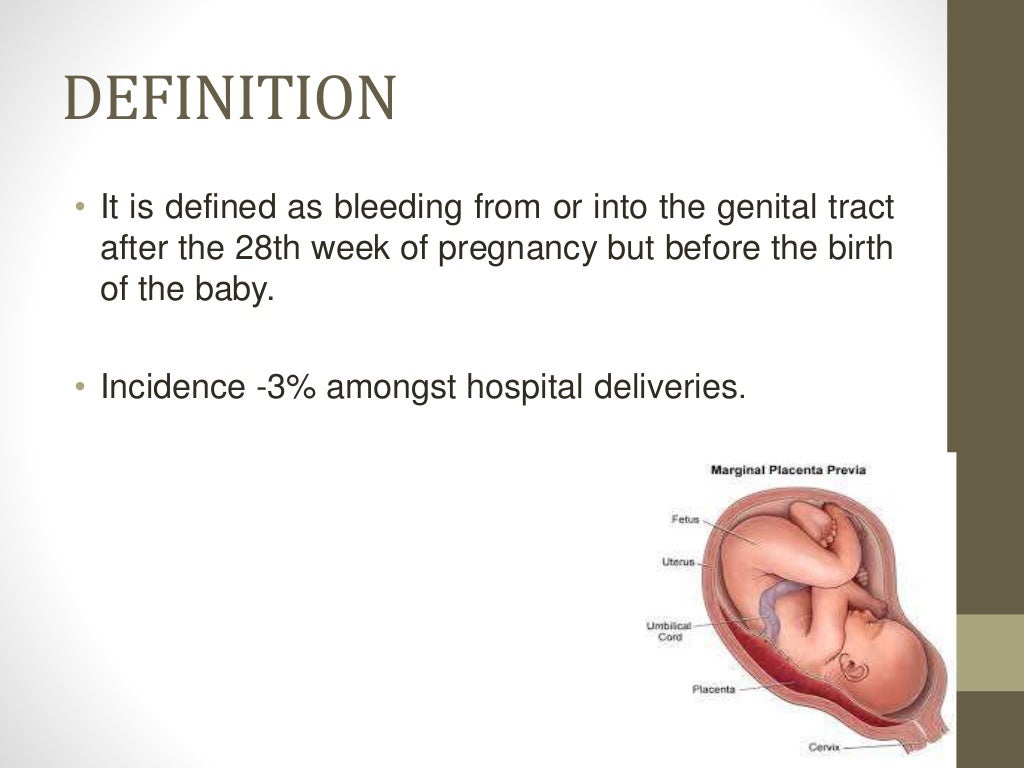 Antepartum Haemorrhage I antepartum-haemorrhage-i