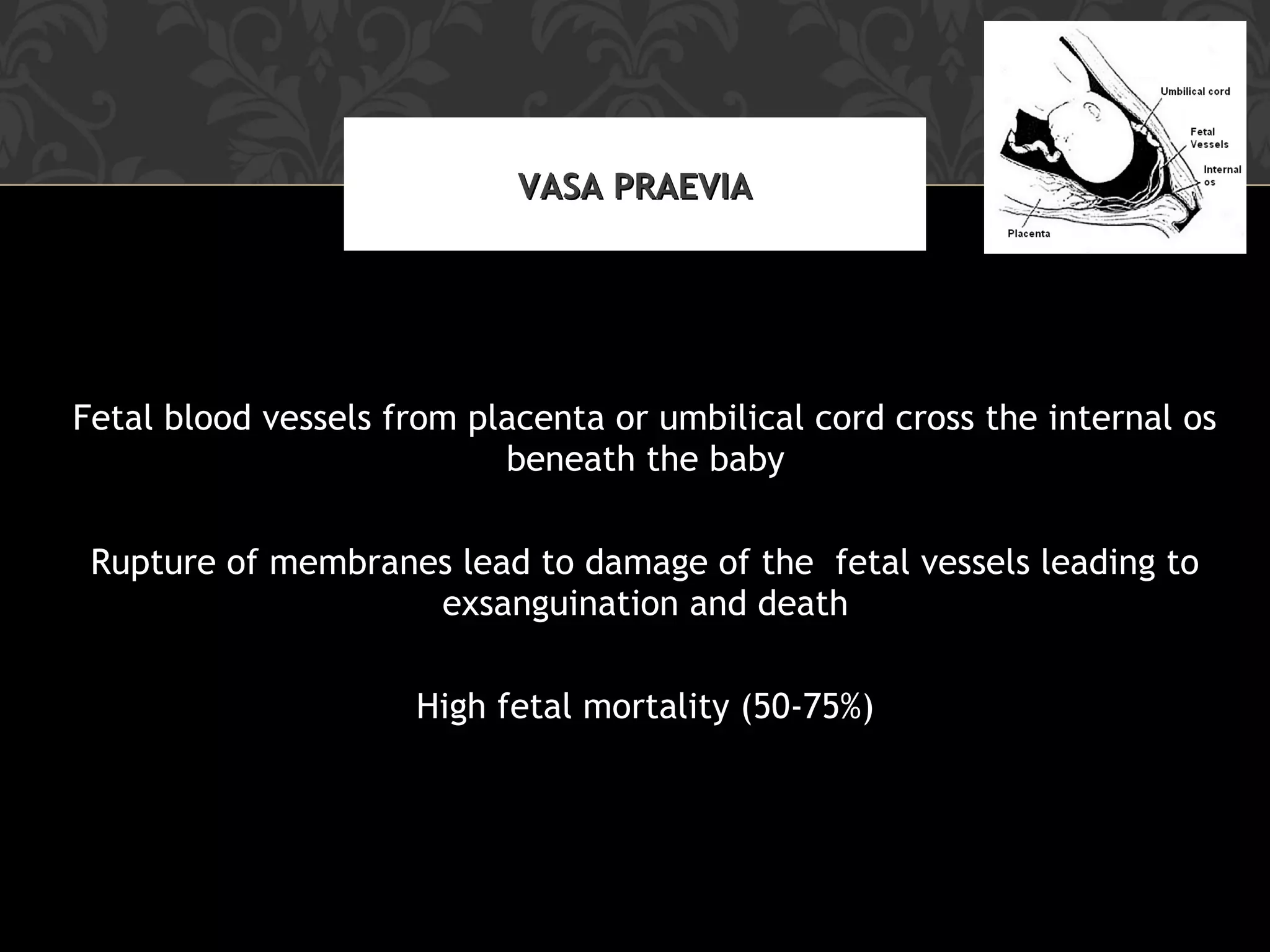 Antepartum hemorrhage | PPT