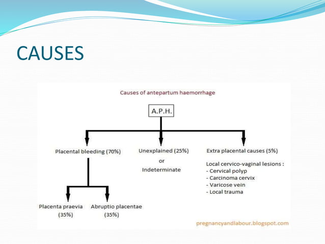 Antepartum hemorrhage BY TANOJ PATIDAR | PPT
