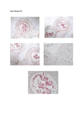 Anter bunga lili | DOCX