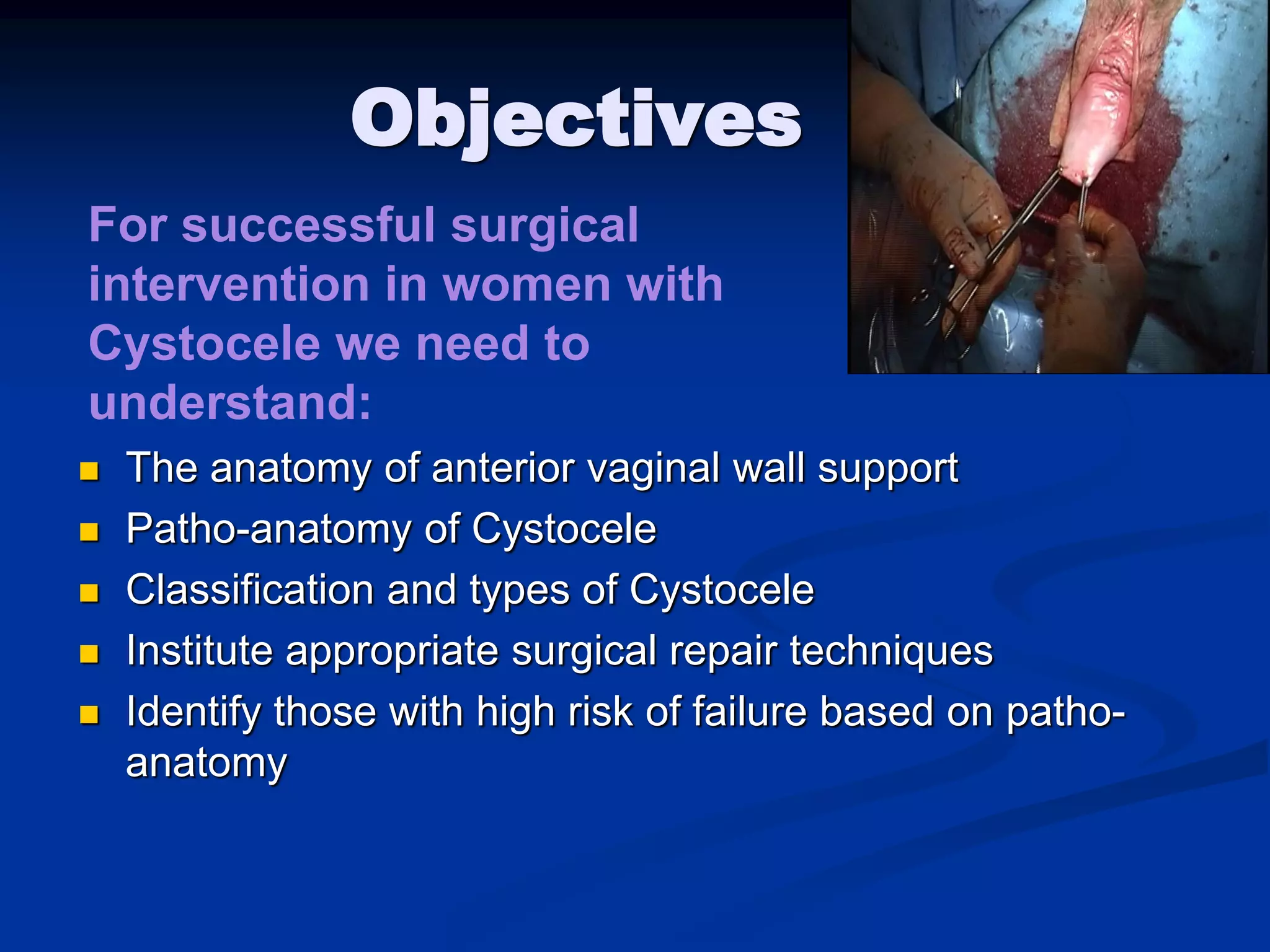 Anterior Compartment Prolapse: Biological Grafts | PDF