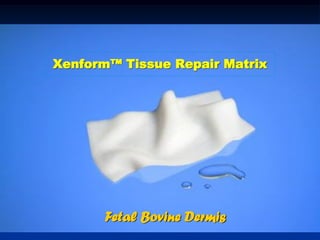 Anterior Compartment Prolapse: Biological Grafts | PDF