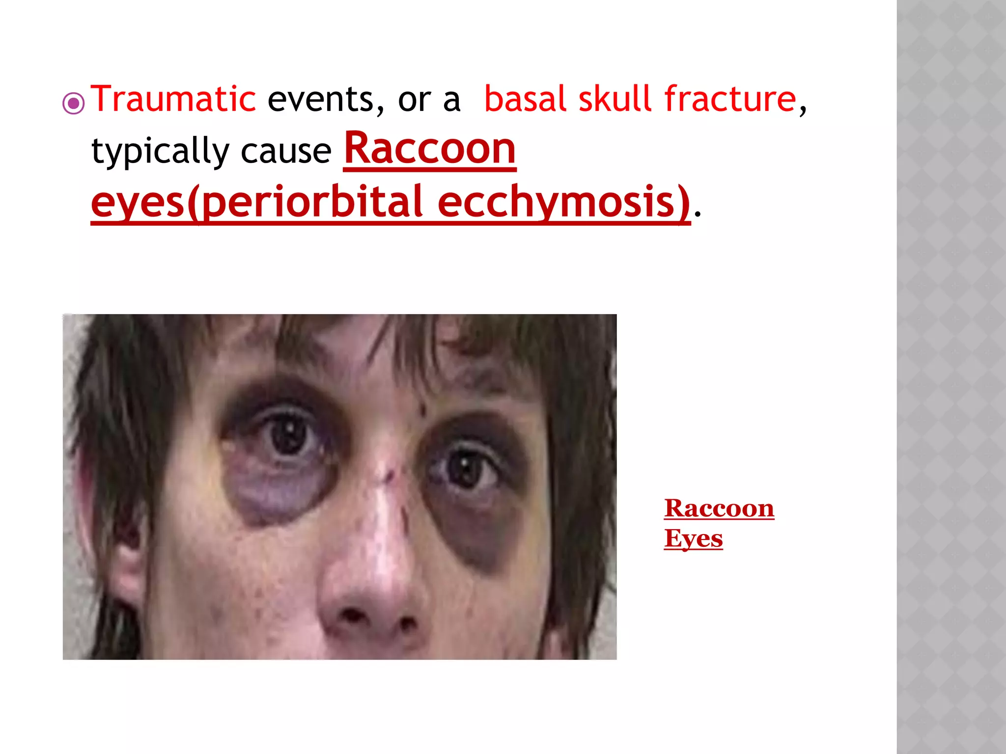 Anterior cranial-fossa | PPT