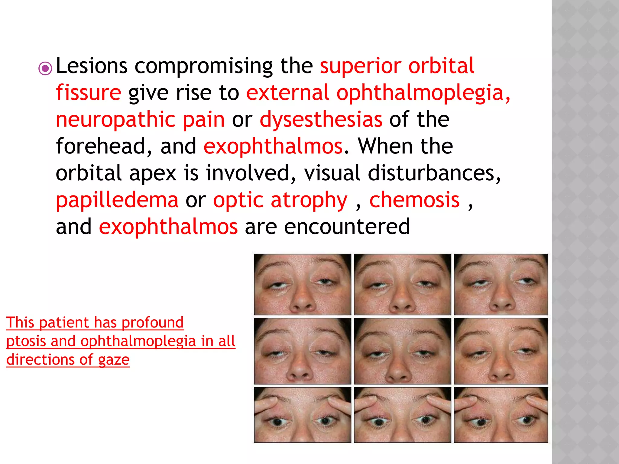 Anterior cranial-fossa | PPT