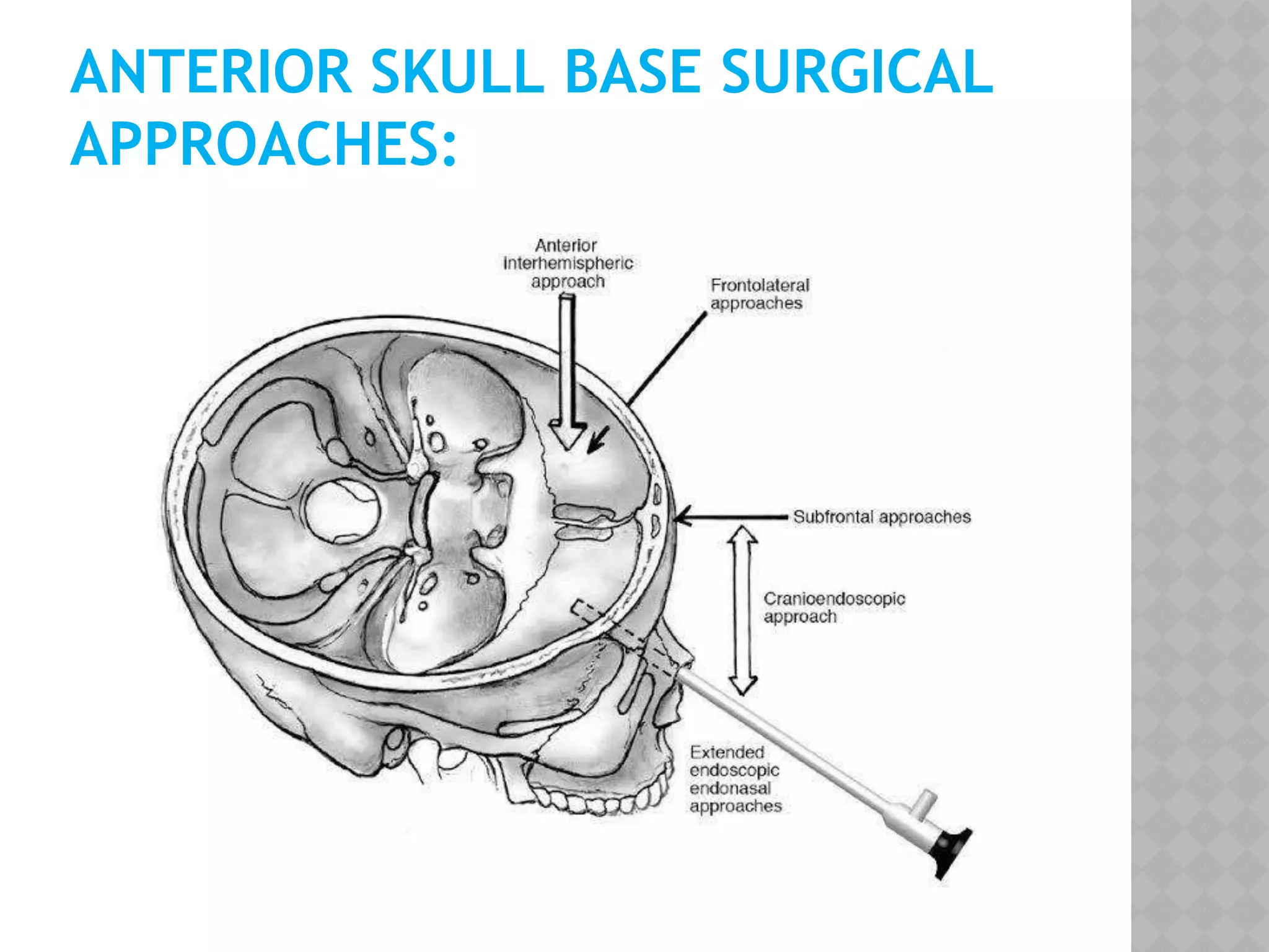 Anterior cranial-fossa | PPT