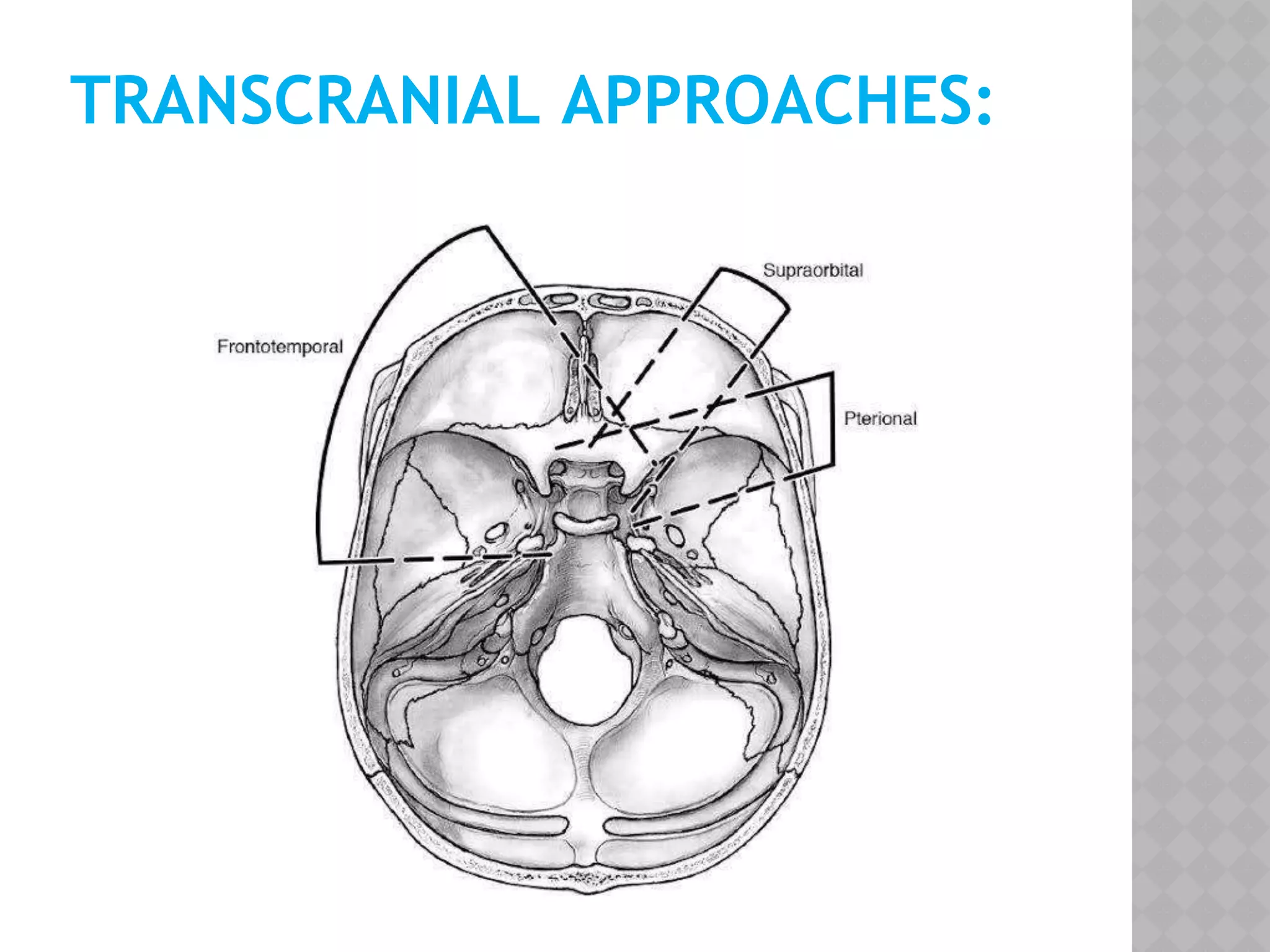 Anterior cranial-fossa | PPT