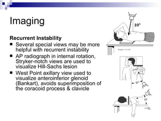 Anterior Glenohumeral Instability | PPT
