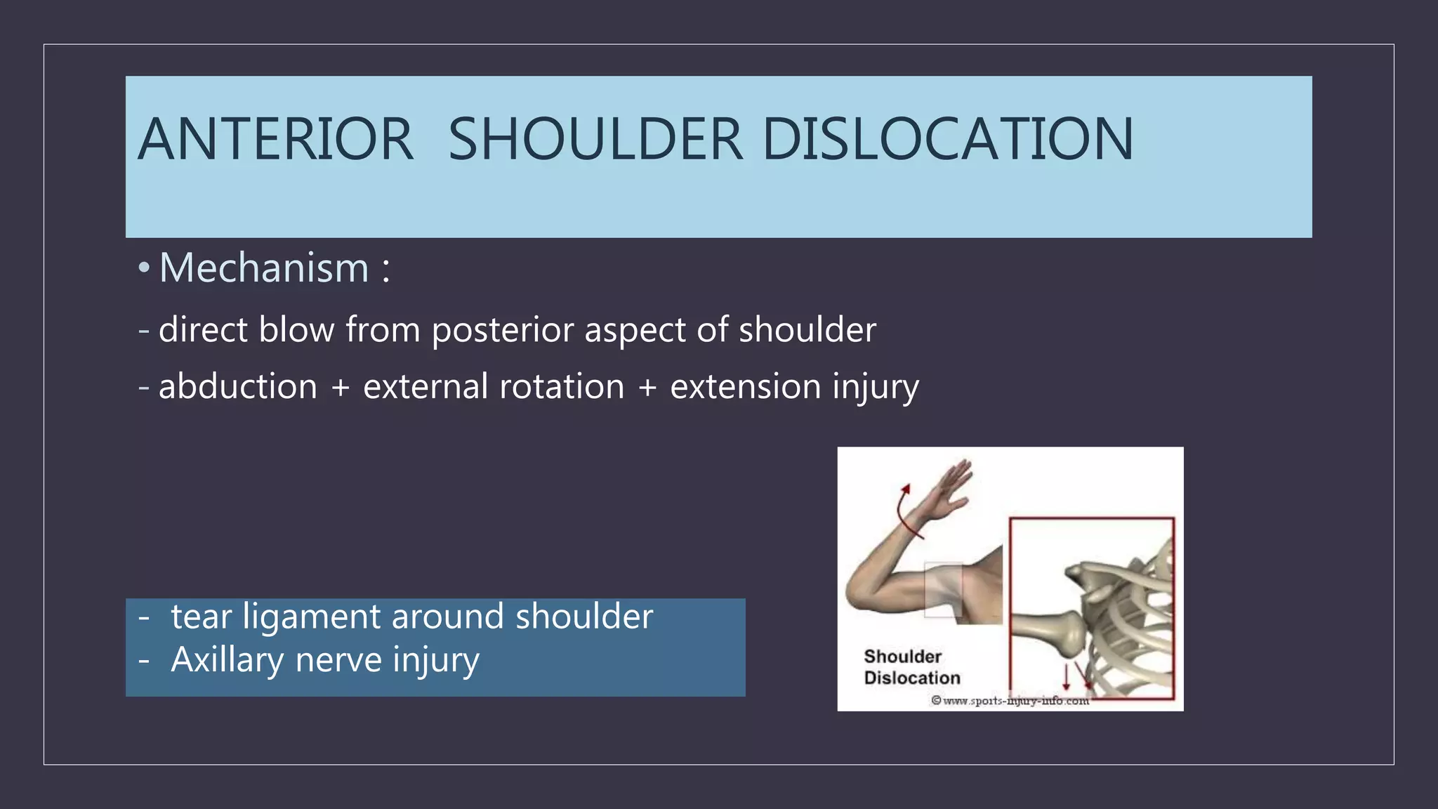 Anterior shoulder-dislocation | PPTX