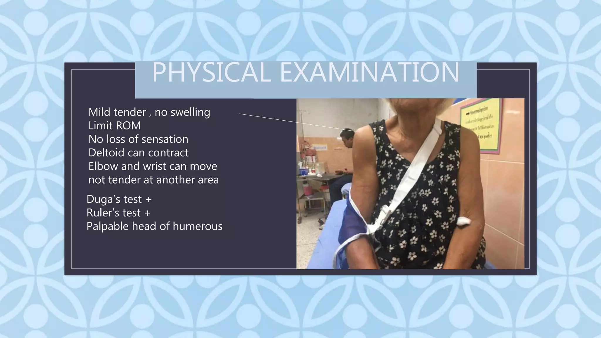 Anterior shoulder-dislocation | PPTX
