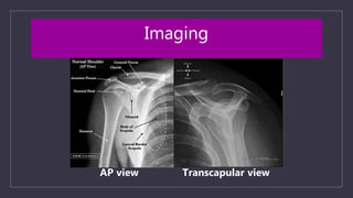 Anterior shoulder-dislocation | PPTX