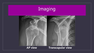 Anterior shoulder-dislocation | PPTX