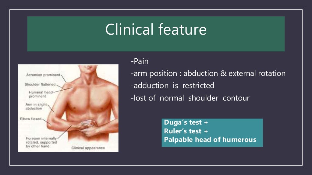Anterior shoulder-dislocation