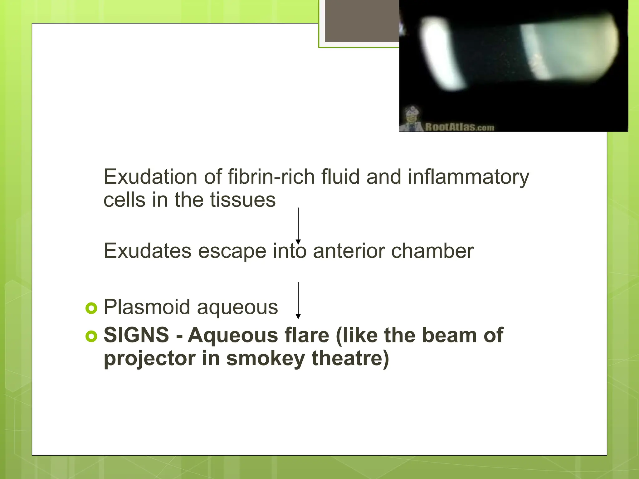 _Anterior-Uveitis.pptx ,,,,,,,,,,,,,,,,, | PPTX