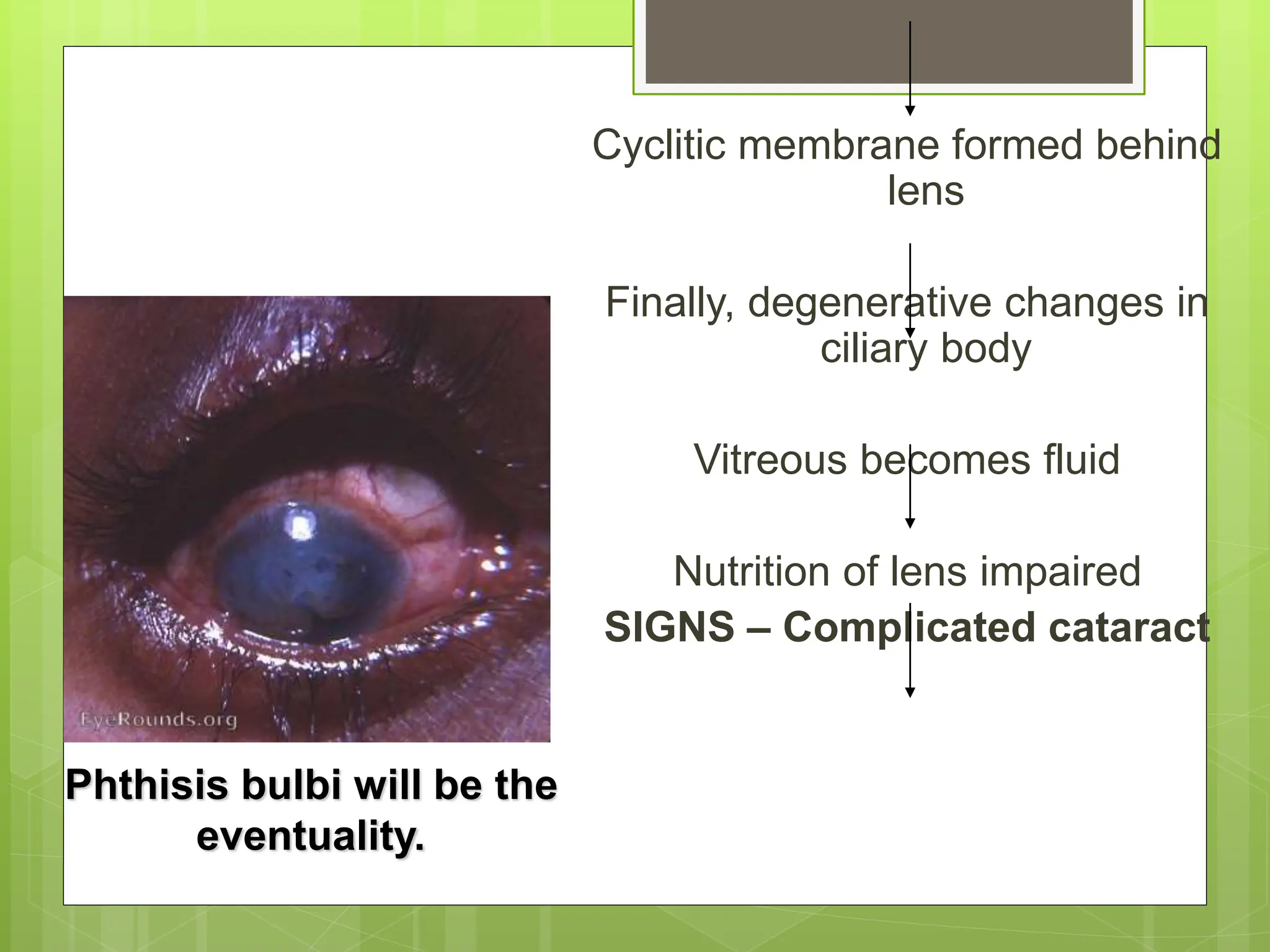 _Anterior-Uveitis.pptx ,,,,,,,,,,,,,,,,, | PPTX