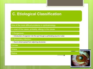 _Anterior-Uveitis.pptx ,,,,,,,,,,,,,,,,, | PPTX