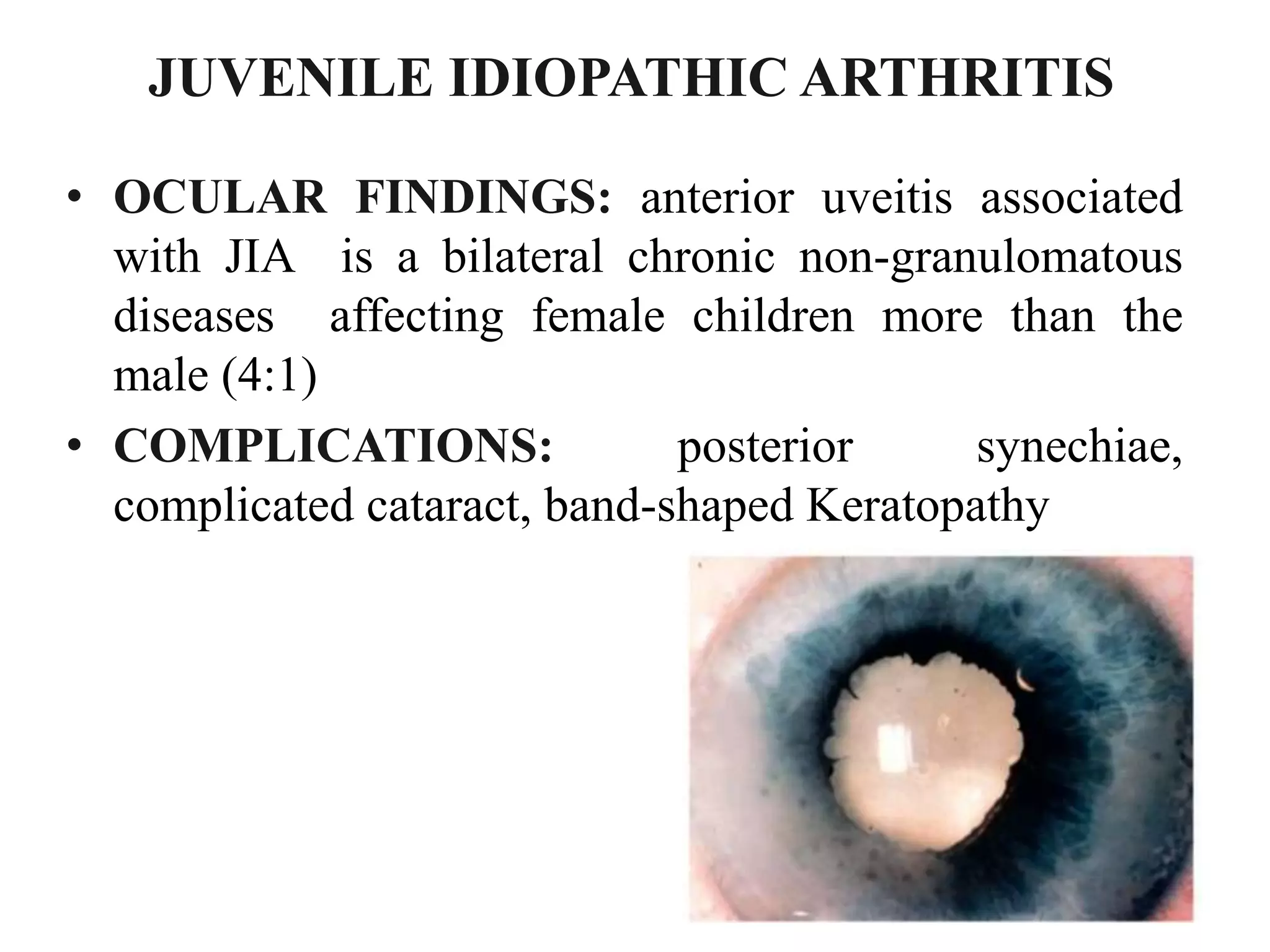 Anterior Uveitis.pptx