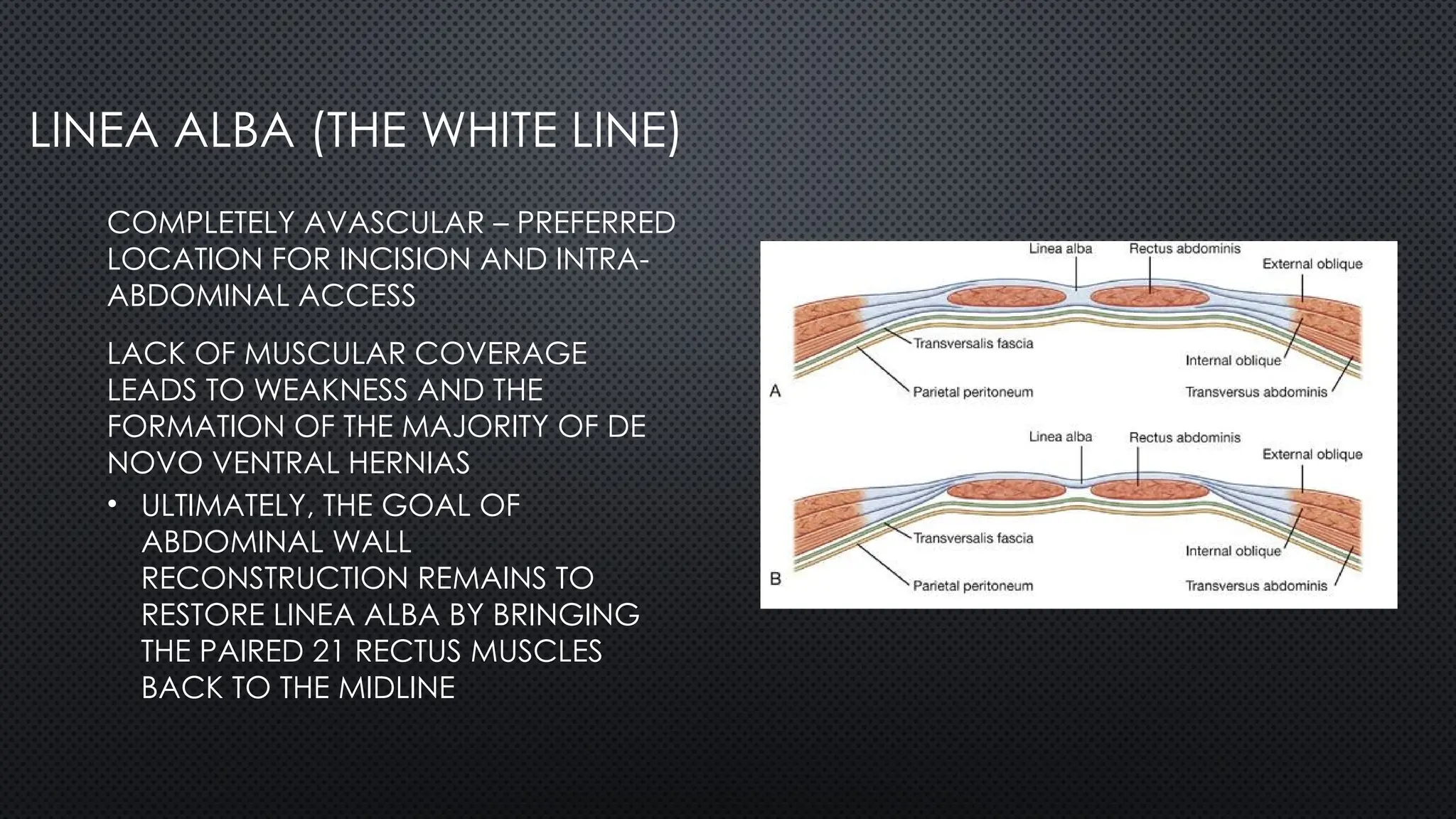 Anterior abdominal wall a surgical notes .pptx