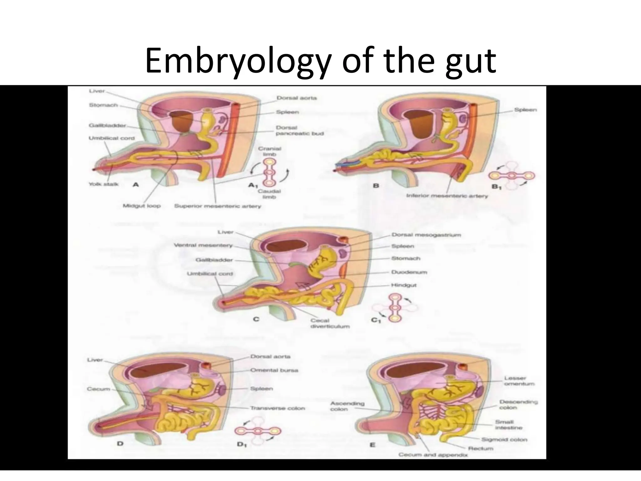 ANTERIOR ABDOMINAL WALL DEFECTS.pptx