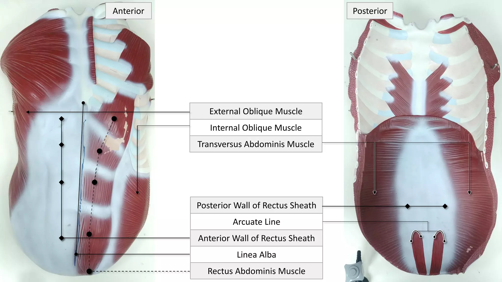 Anterior abdominal wall lab summary | PPT