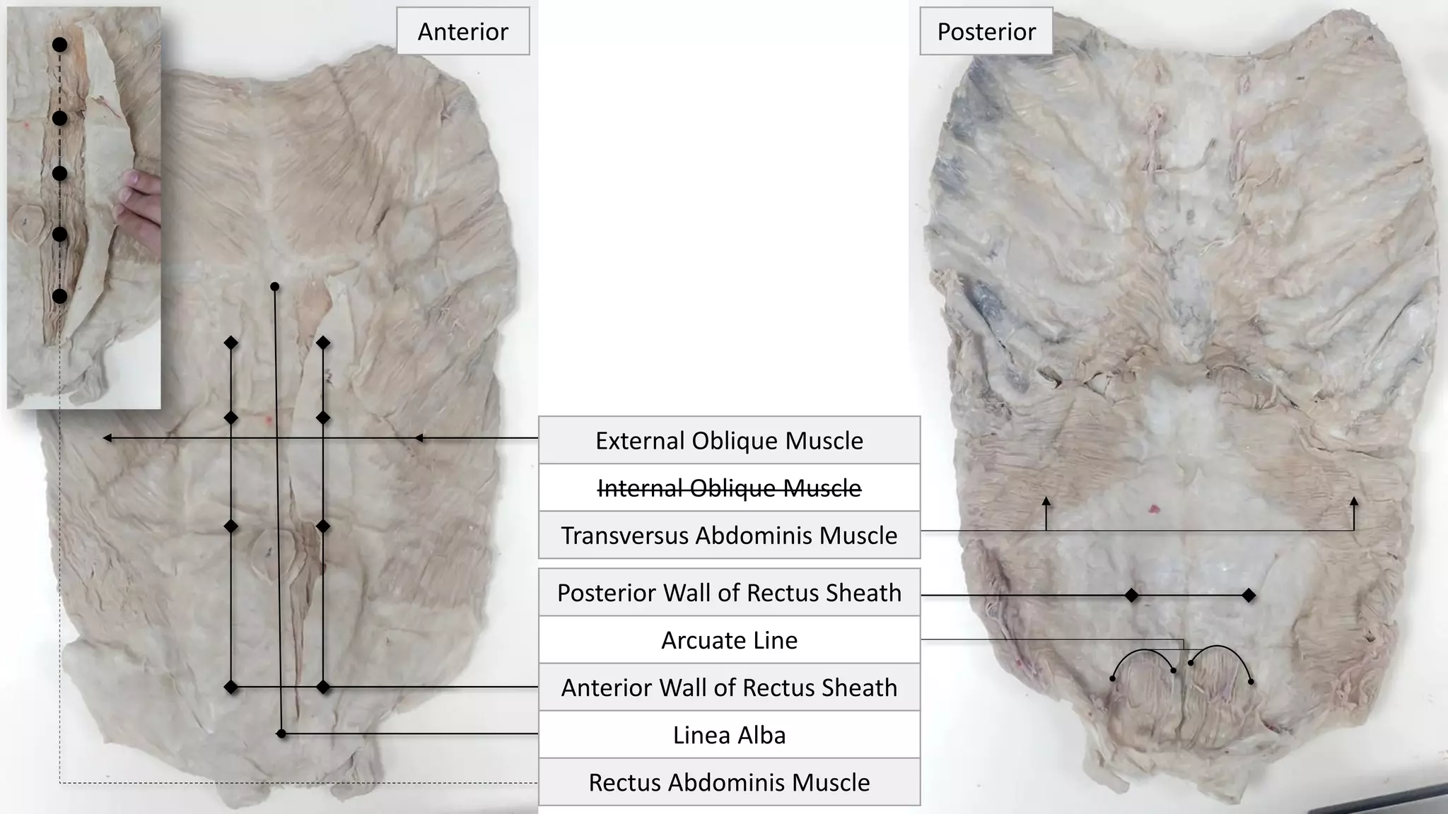 Anterior abdominal wall lab summary | PPT
