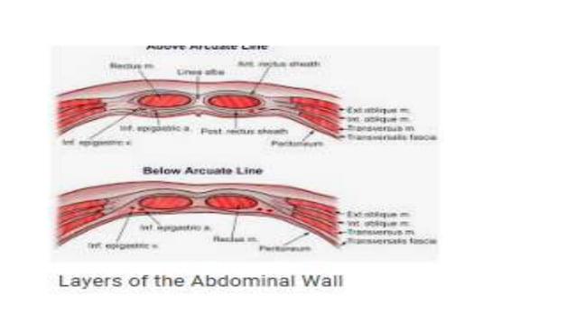 Anterior abdominal wall , Rectus sheath and Inguinal.pptx | Pregnancy ...