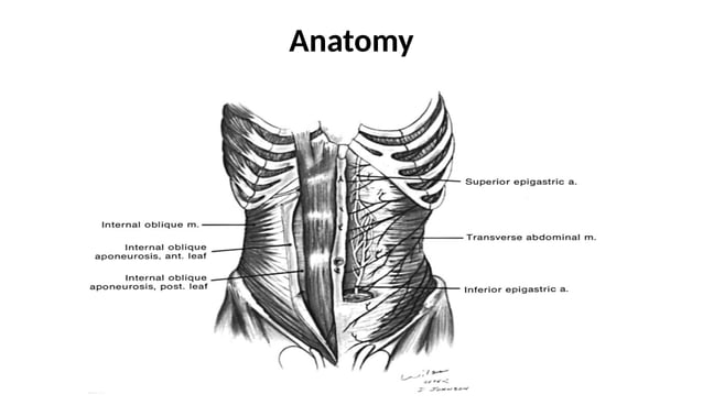Anterior abd wall defects presentation.pptx
