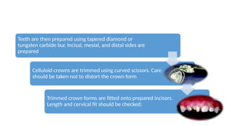 anterior aesthetic crown.anterior aesthetic crown. | PPTX