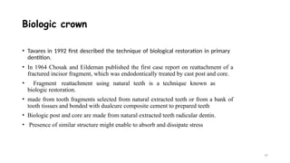 anterior aesthetic crown.anterior aesthetic crown. | PPTX