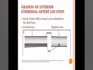 ANTERIOR AND POSTERIOR ETHMOID ARTERIES.pptx