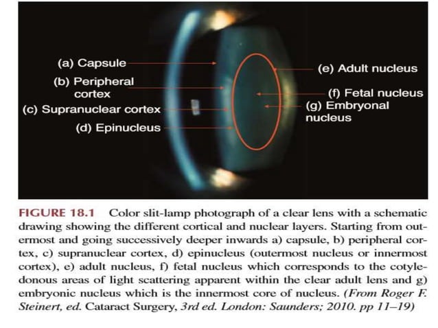 Anterior and posterior segment of eye | PPTX | Eye and Vision ...
