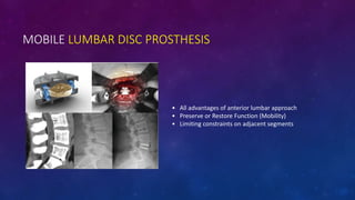Anterior Approach & Lumbar Disc Prosthesis | PPT